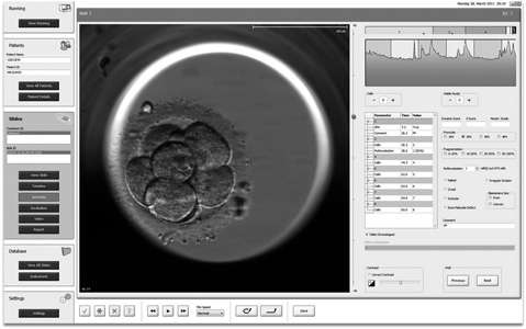 Embryoscope - First Photo of You Baby - IVI